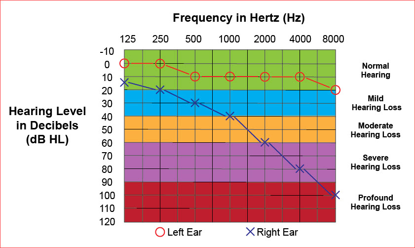 Hearing Tests audiometry UCHealth