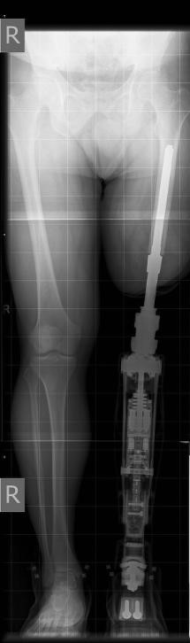 UCHealth Orthopedics Clinic – Anschutz Medical Campus | metro Denver