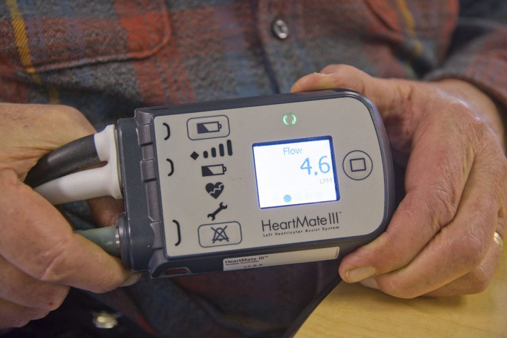 Man marks second LVAD anniversary and a life renewed - UCHealth Today