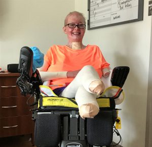 Burn survivor spent 425 days hospitalized and relishes each day alive