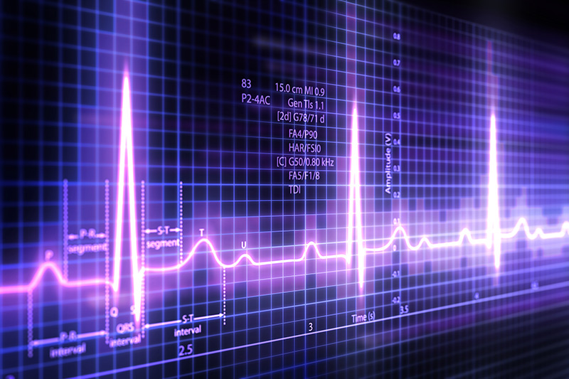 Harnessing artificial intelligence to predict atrial fibrillation ...