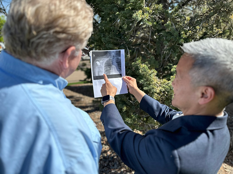 Arthroplasty shoulder surgery, love for outdoors, brought these ...